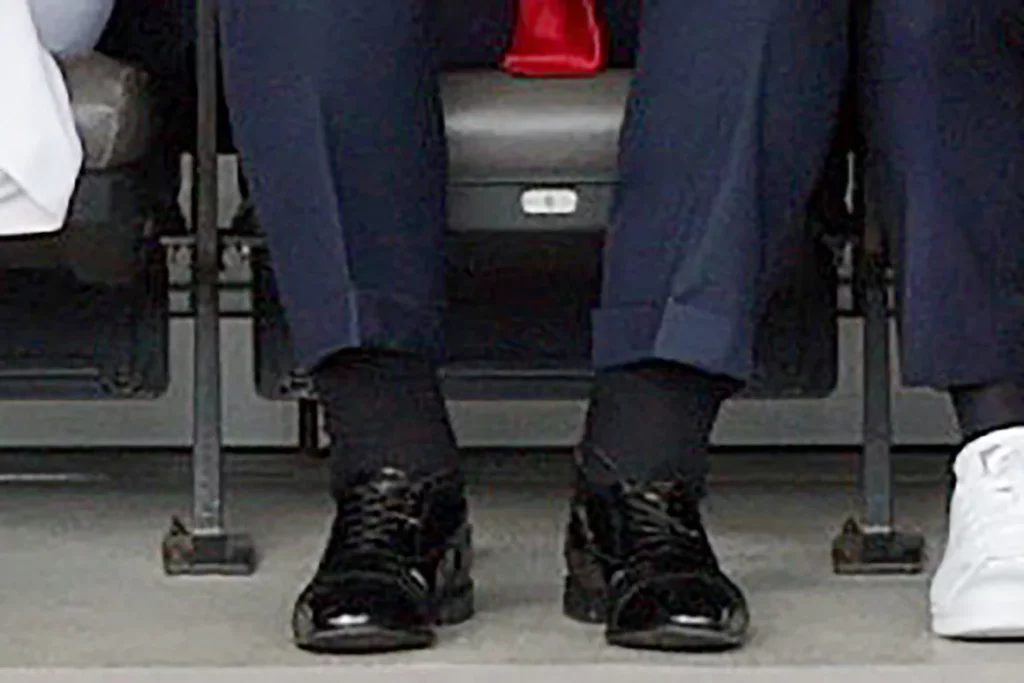 Donald Trump diagnosed with chronic venous insufficiency following leg ...